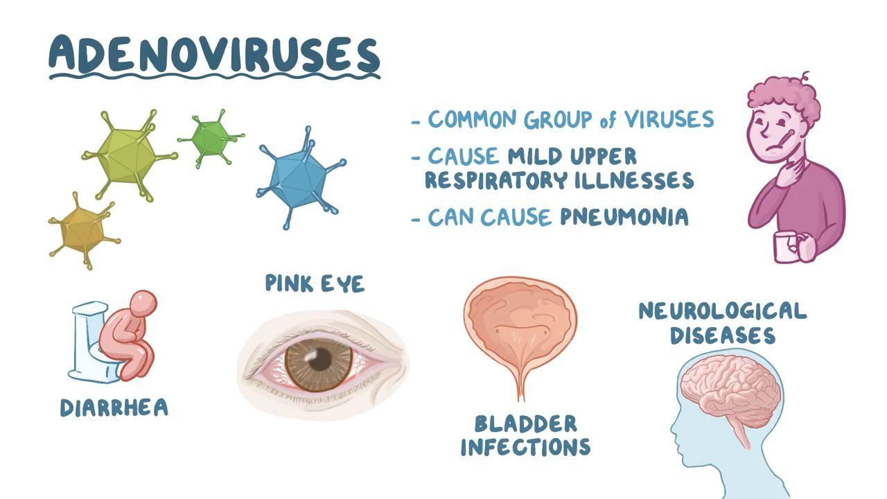 Video: Knowledge Shot: Are you at risk of an adenovirus infection | Osmosis