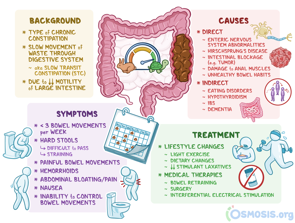 Lazy Bowel Syndrome: What Is It, Causes, Treatment, and More | Osmosis