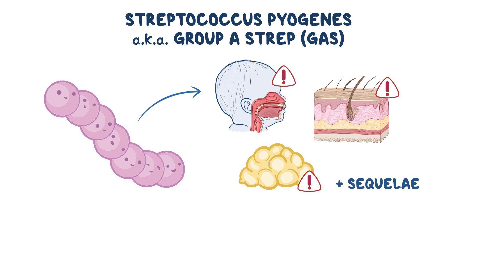 Video: Acute group A streptococcal infections and sequelae (pediatrics ...