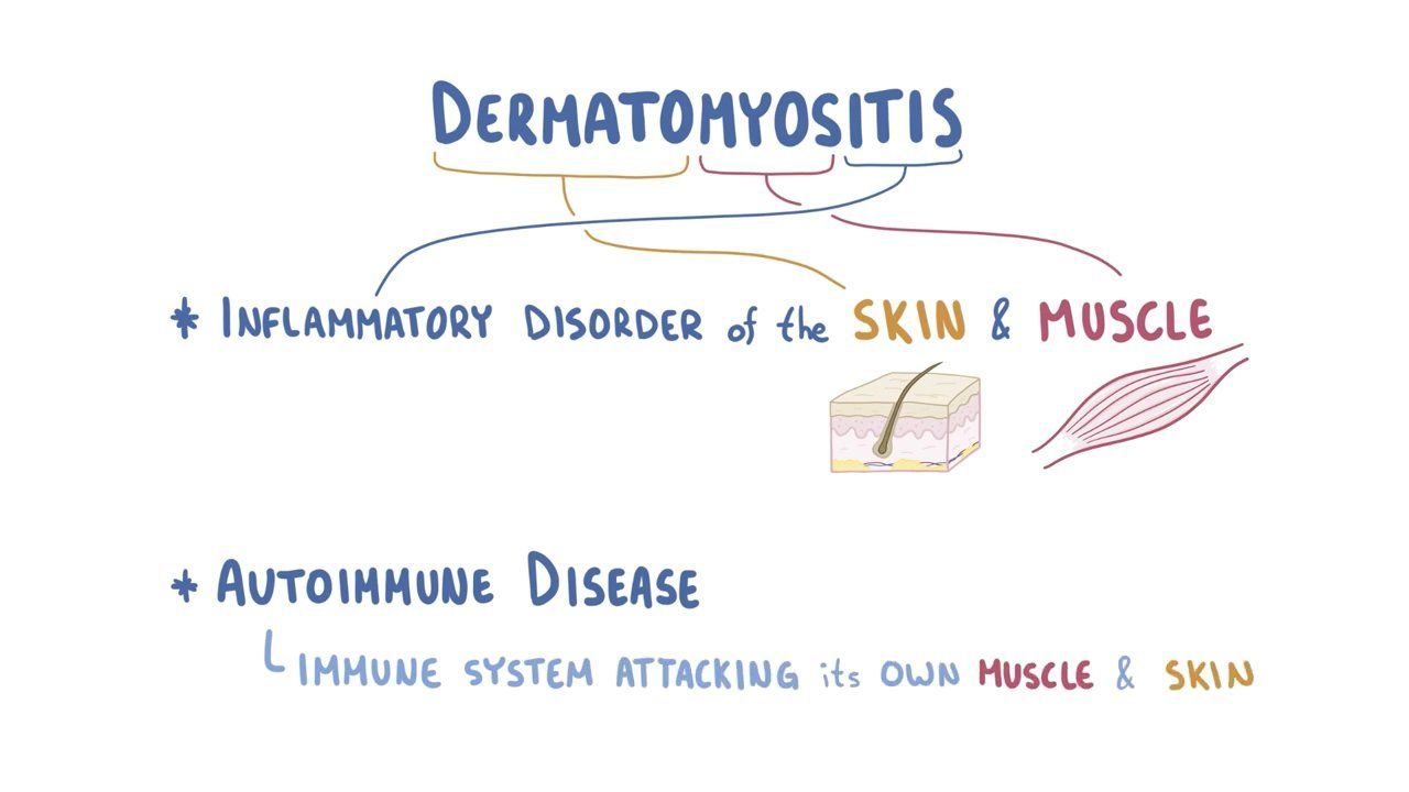 Video: Dermatomyositis | Osmosis