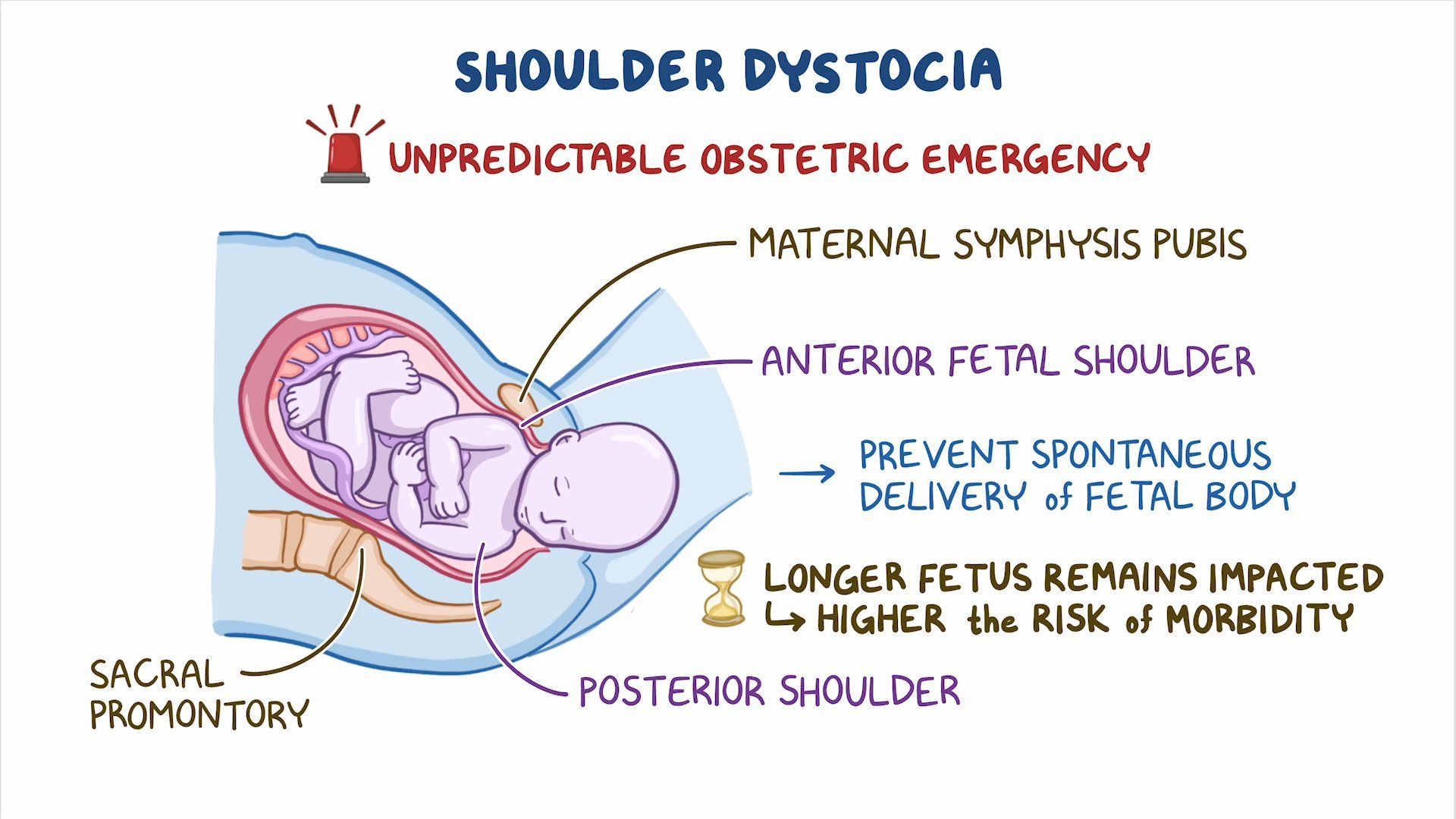 Video: Shoulder dystocia: Clinical sciences | Osmosis