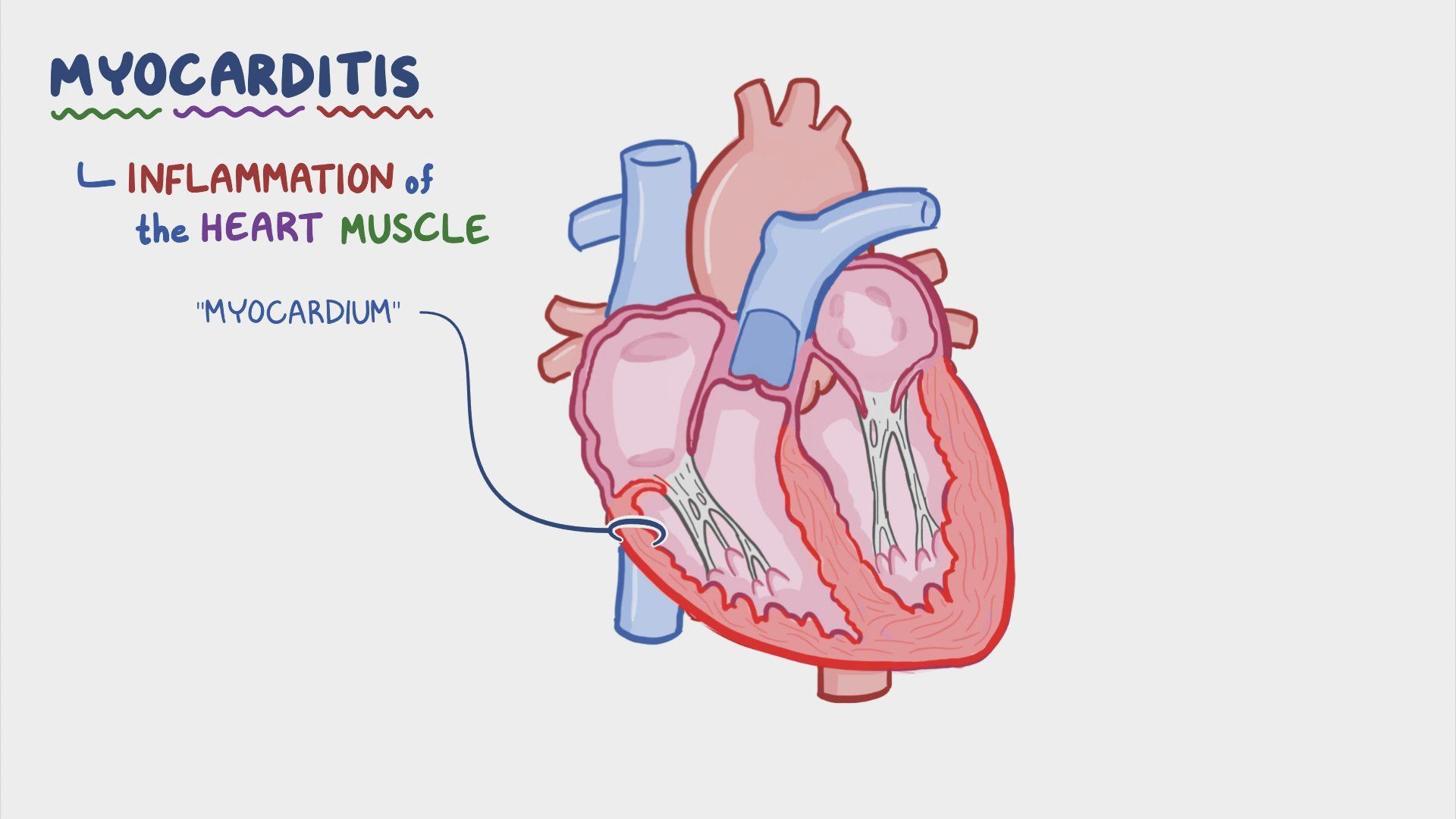Video: Myocarditis: Nursing