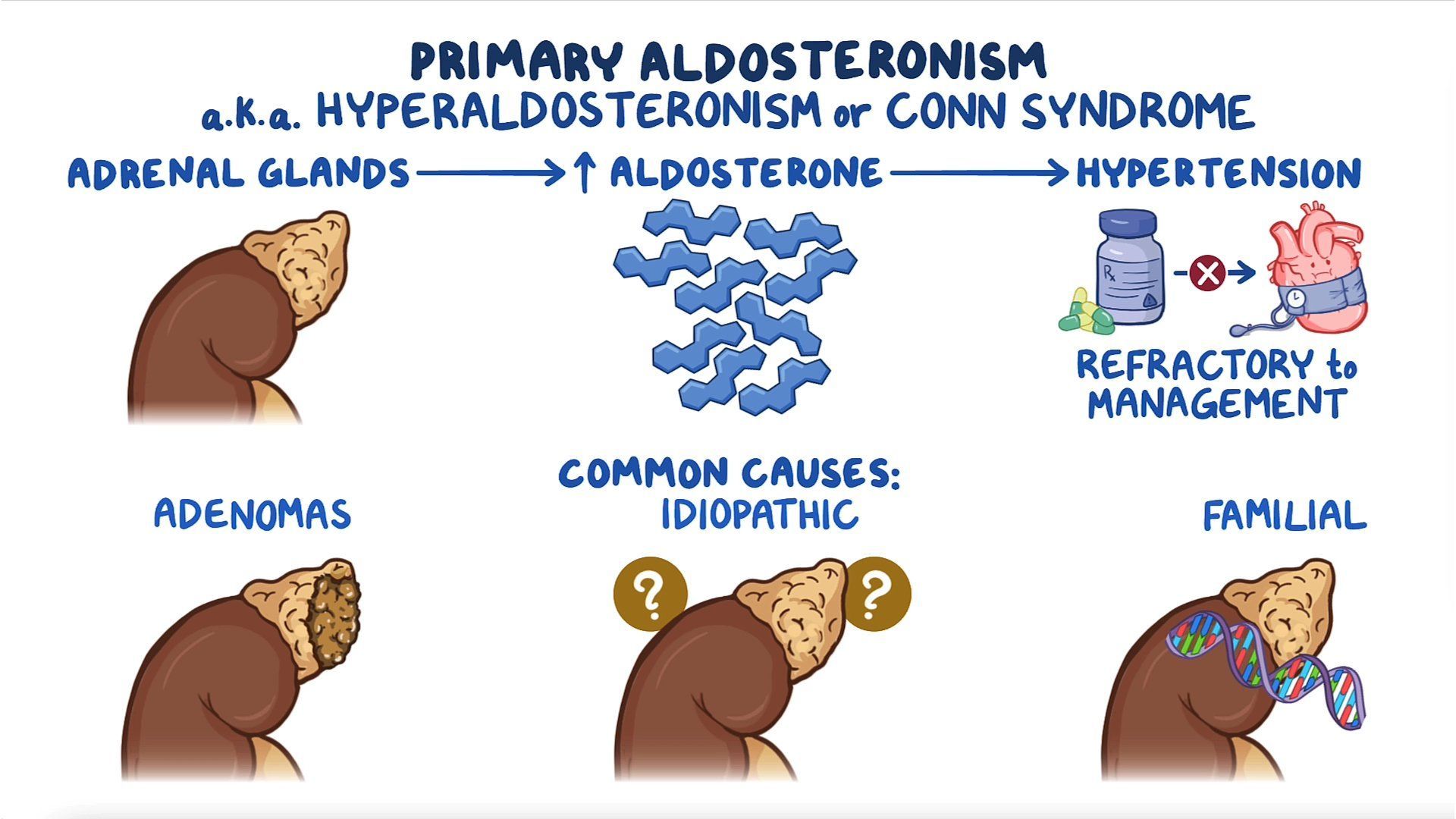 Video: Primary aldosteronism (hyperaldosteronism): Clinical sciences