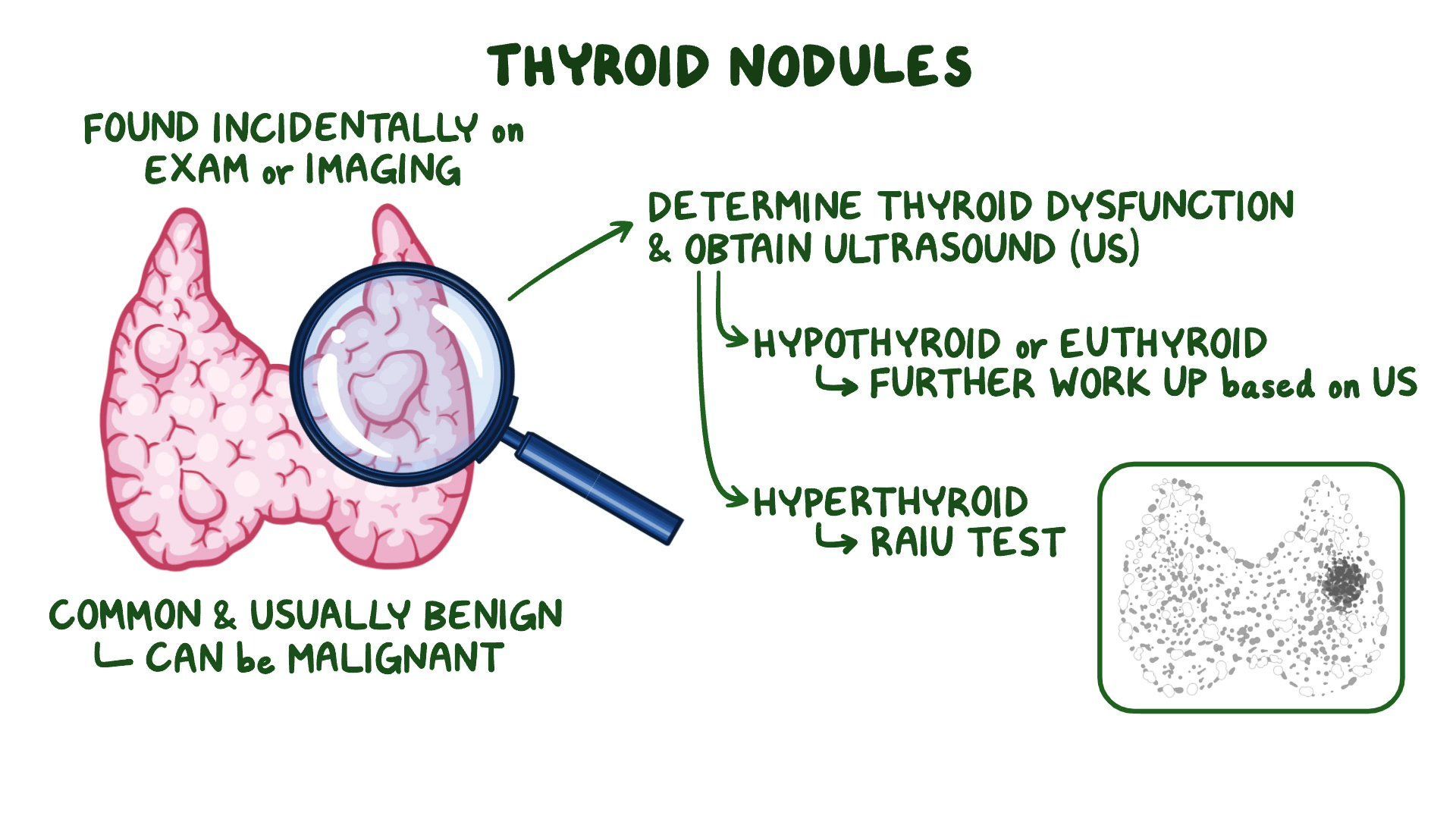 Video: Thyroid nodules: Clinical sciences | Osmosis