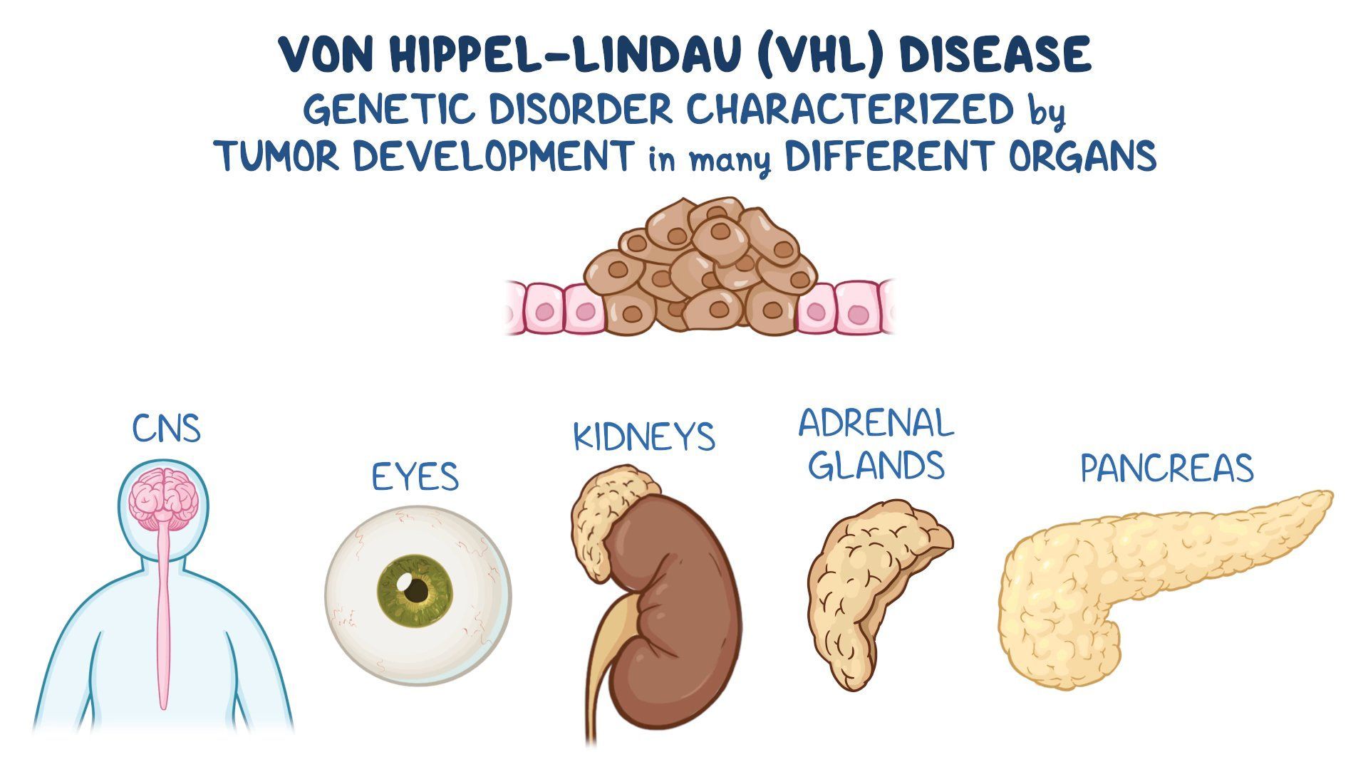 Video: Von Hippel-Lindau disease: Year of the Zebra 2024 | Osmosis