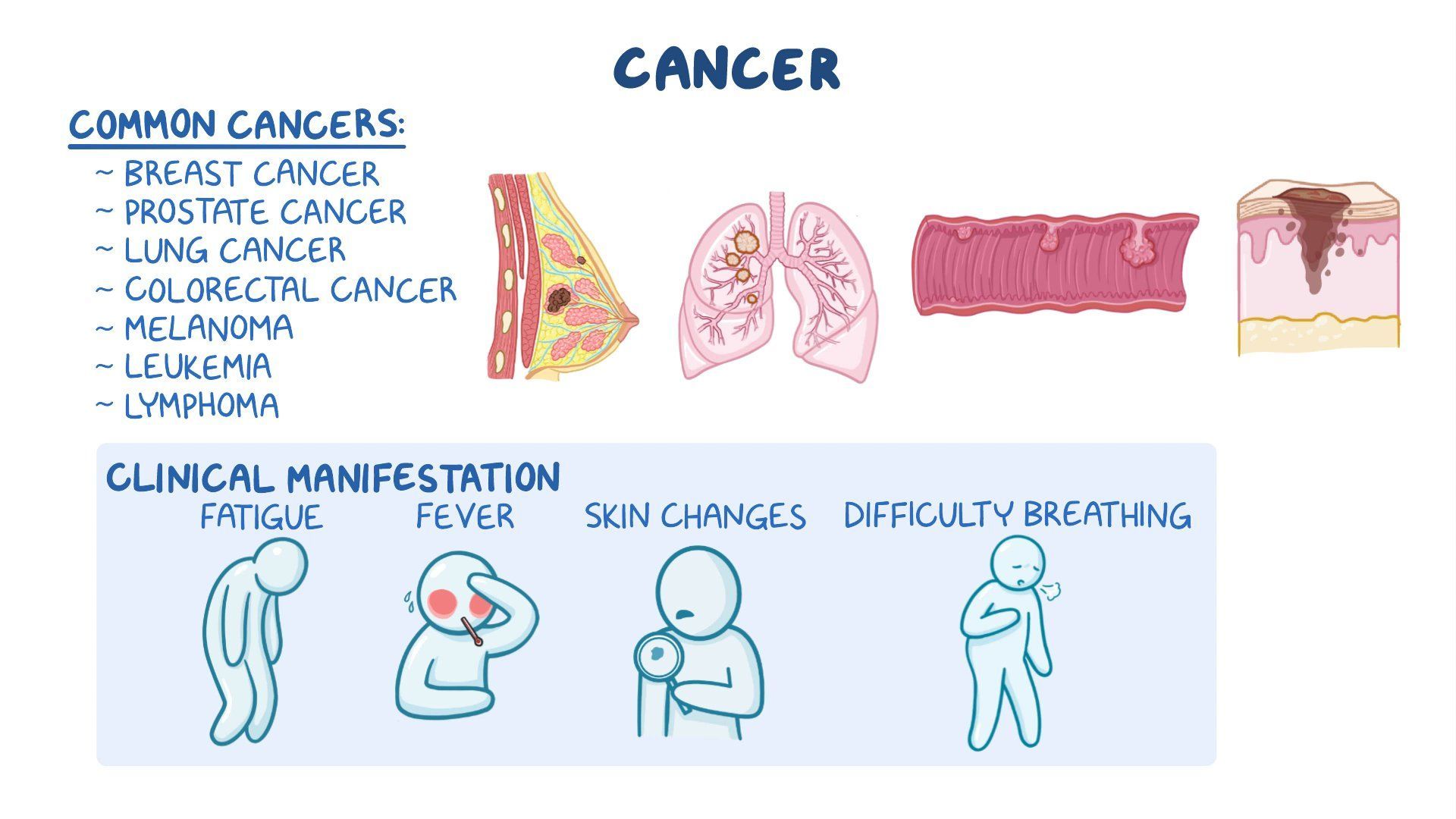 Video: Biology of cancer: Nursing | Osmosis
