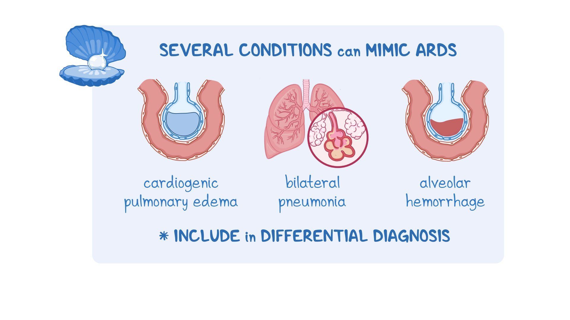 Video: Acute respiratory distress syndrome: Clinical sciences | Osmosis
