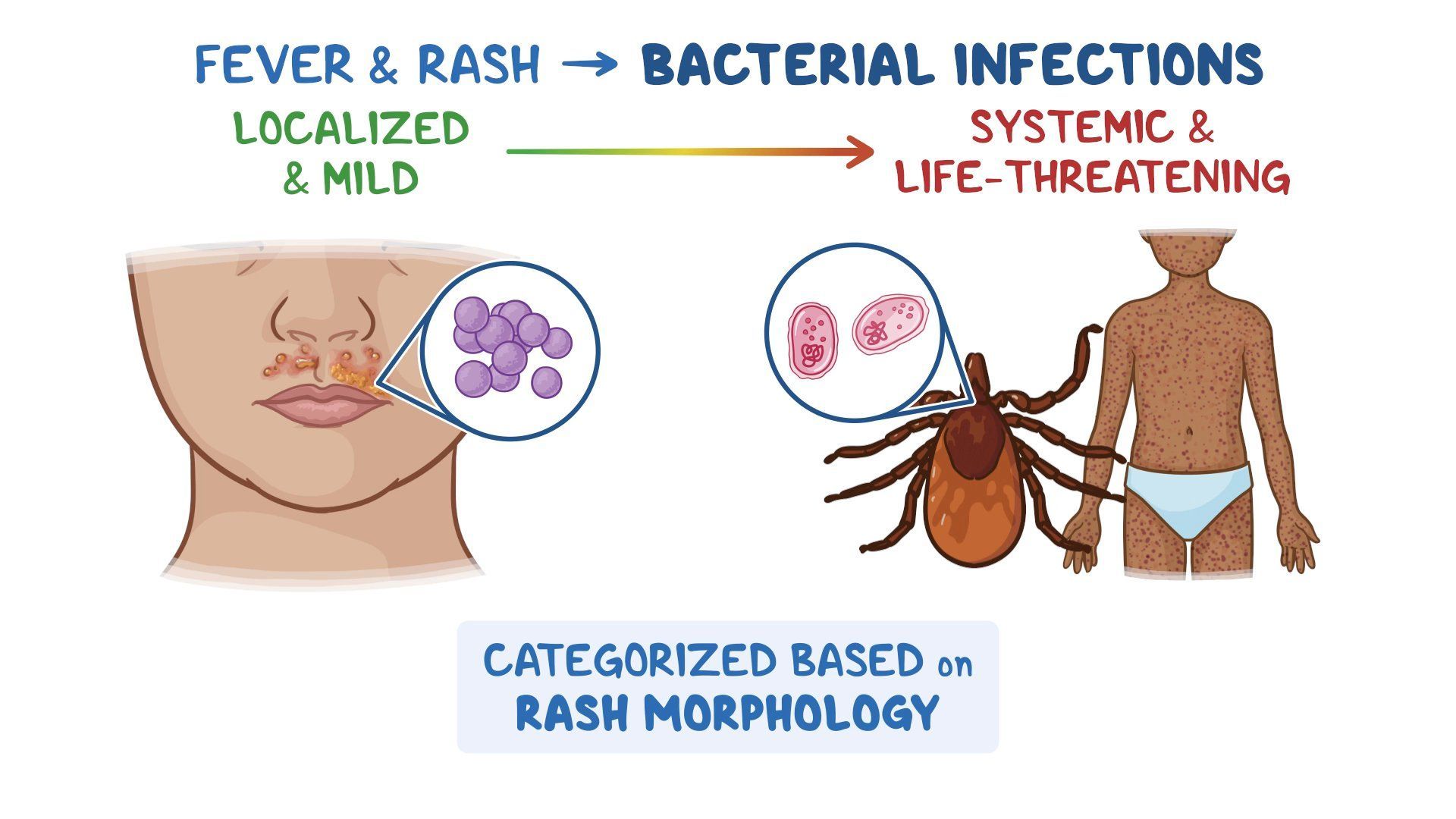 Video: Approach to bacterial causes of fever and rash (pediatrics ...