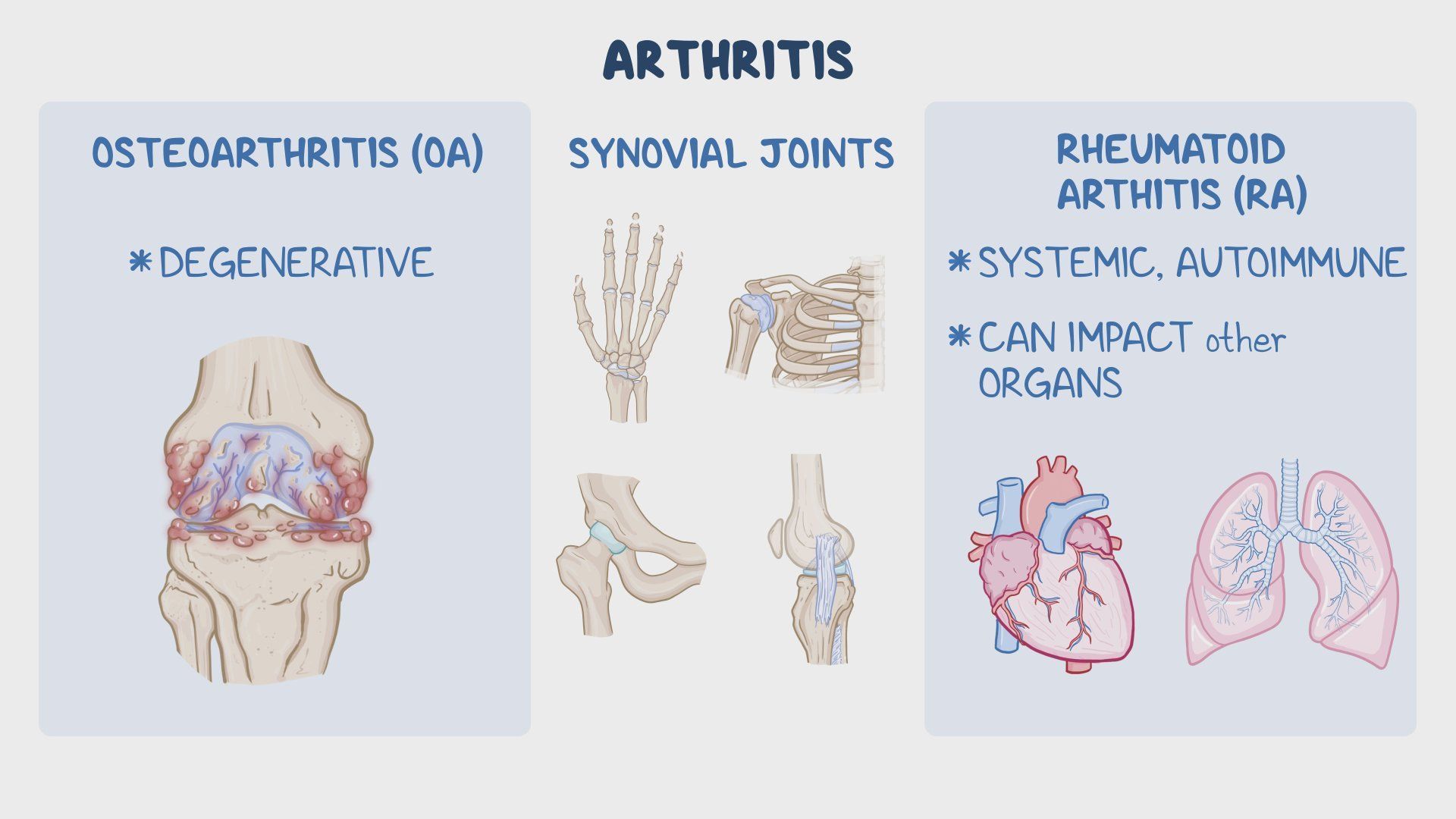 Video Arthritis Osteoarthritis And Rheumatoid Arthritis Osmosis