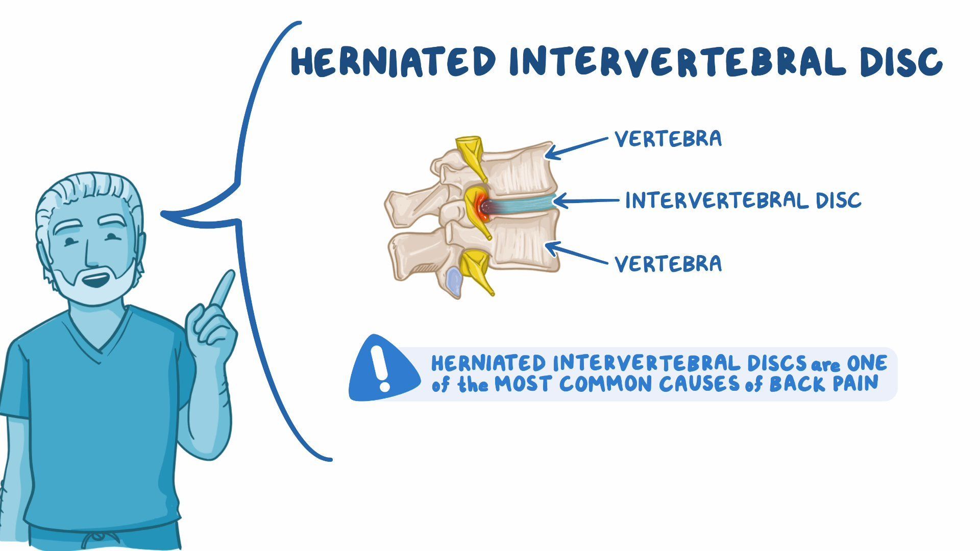 Video: Herniated intervertebral disc: Nursing | Osmosis