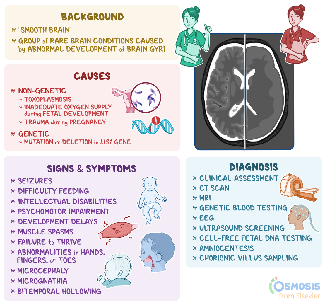 Lissencephaly: What Is It, Diagnosis, Treatment, and More | Osmosis