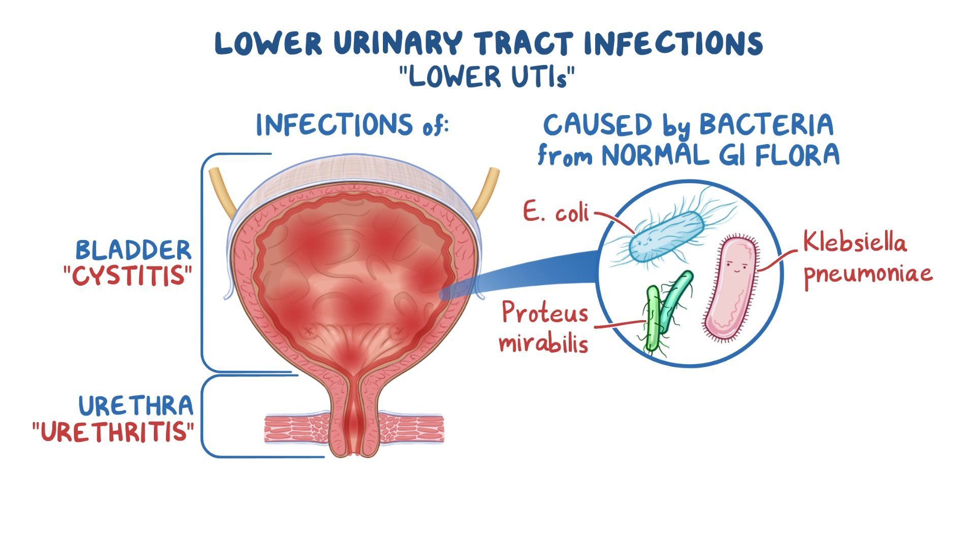 Pathophysiology Of Lower Urinary Tract Infection