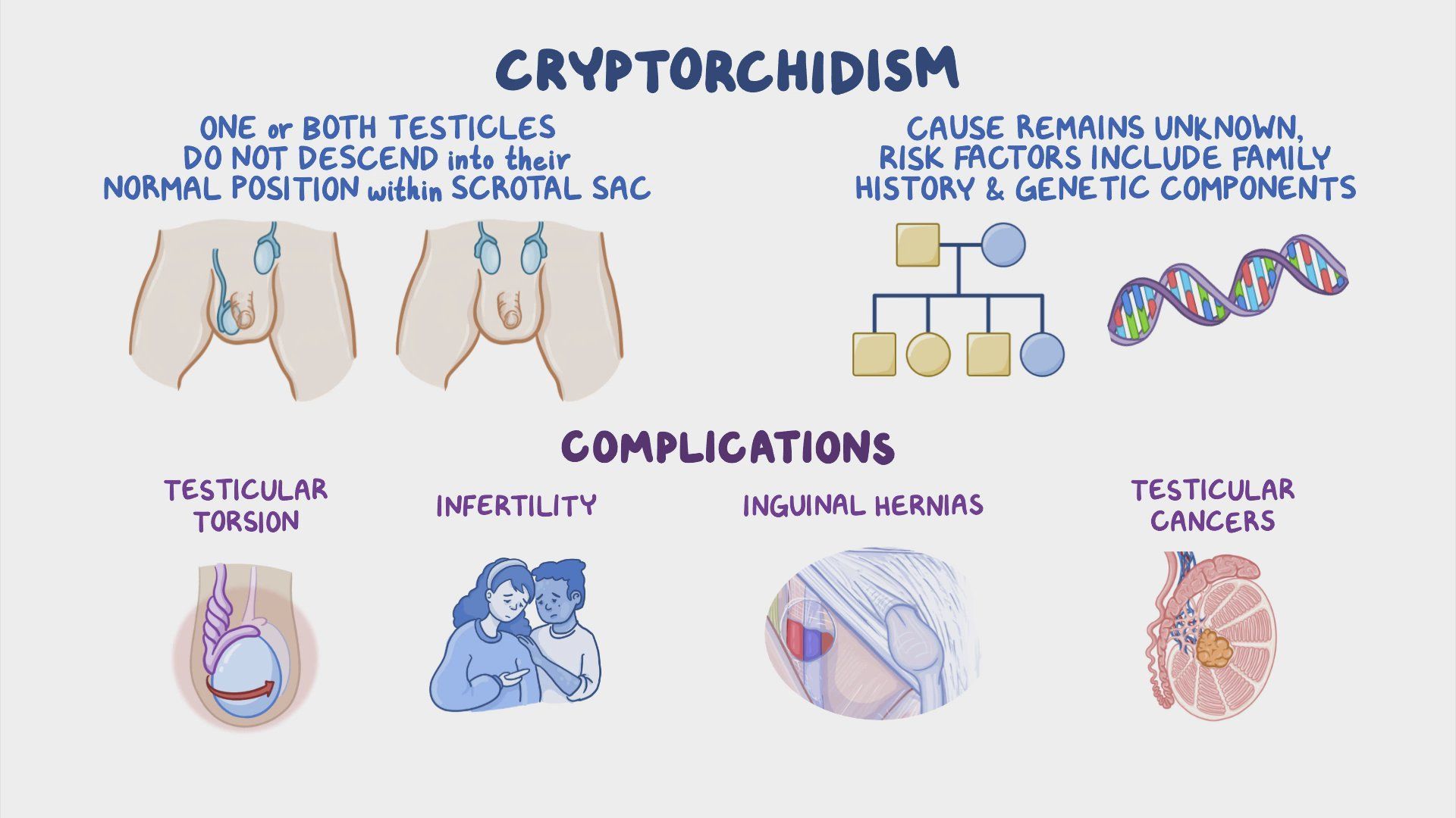 Video: Cryptorchidism: Nursing | Osmosis