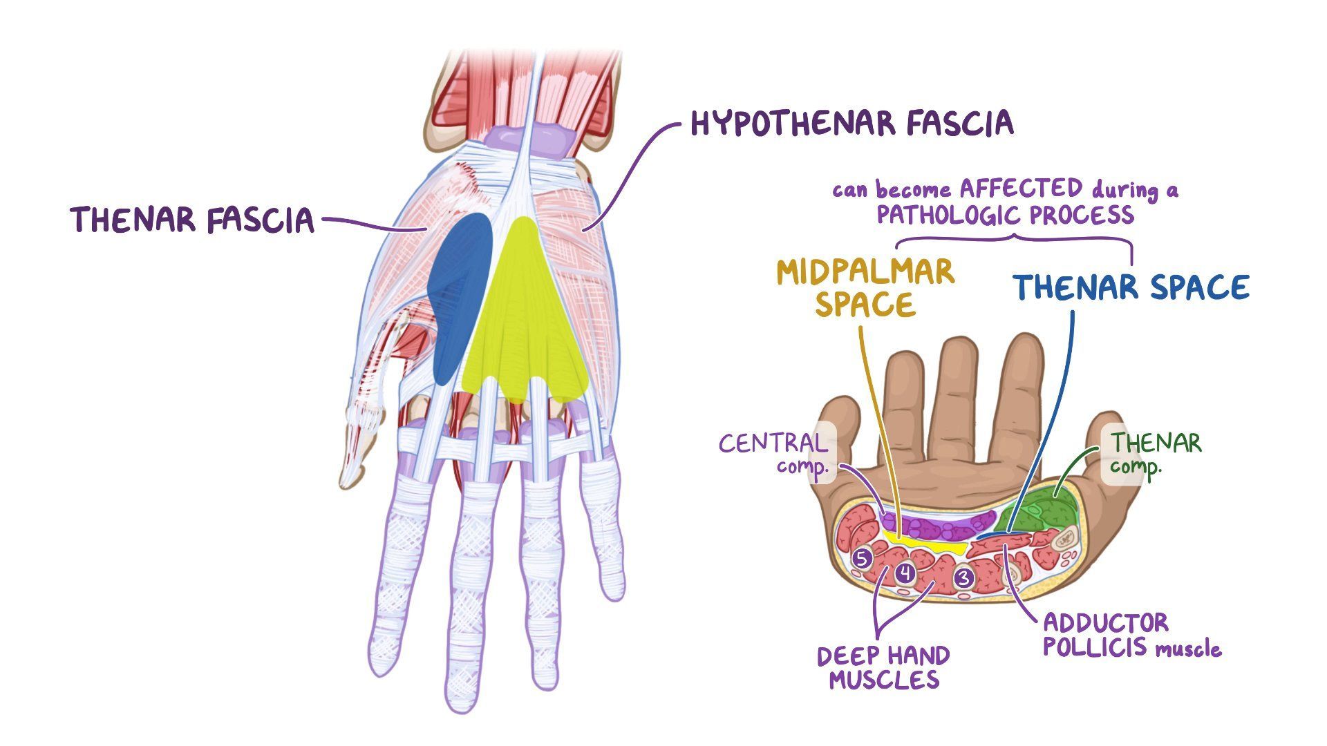 Muscles of the hand - Osmosis