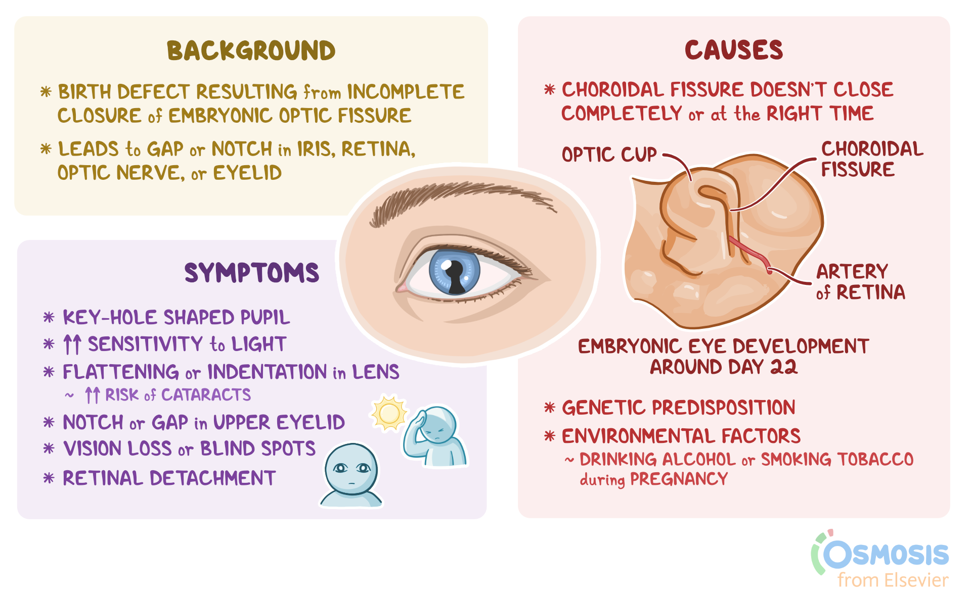 Coloboma: What Is It, Signs and Symptoms, Diagnosis, and More | Osmosis