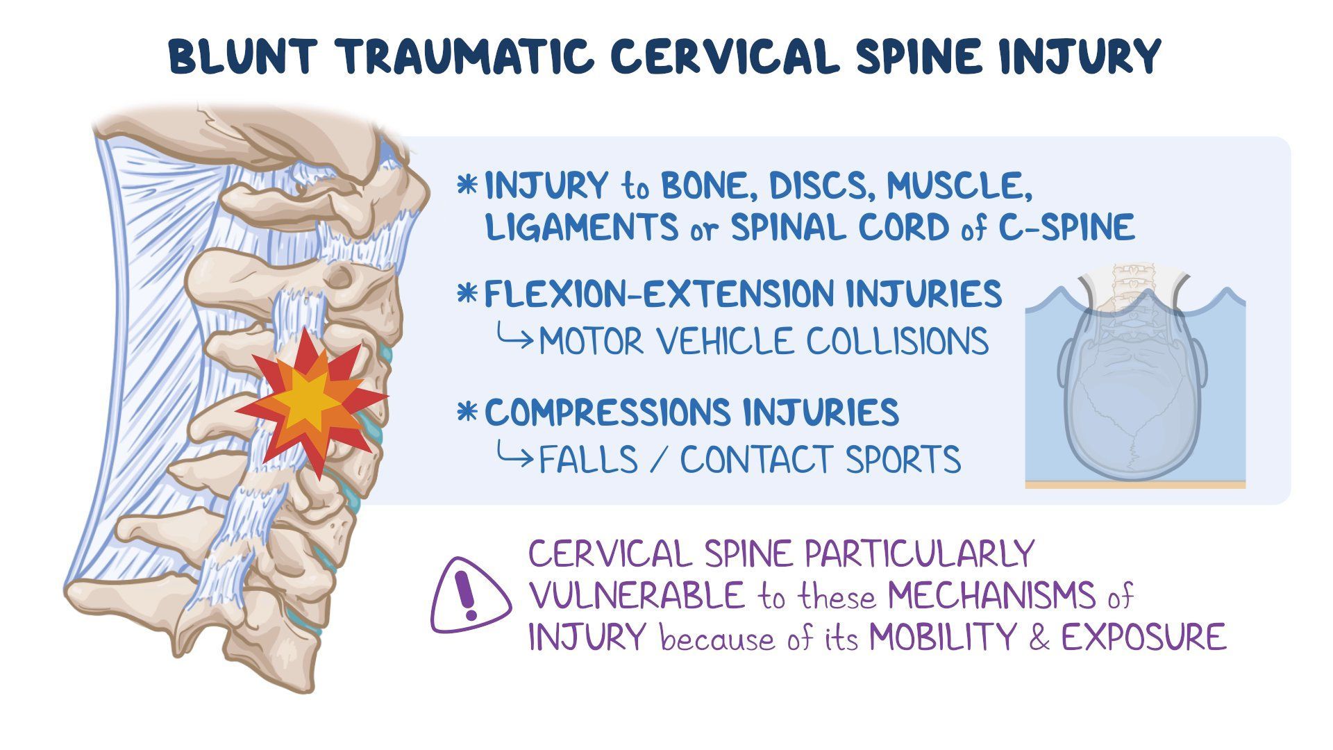 Video: Approach to blunt traumatic cervical spine injuries: Clinical sciences | Osmosis