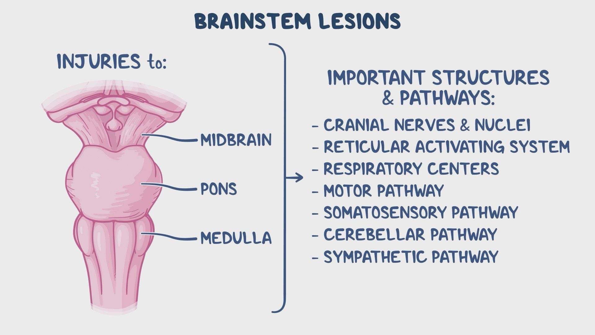 Video: Approach to differentiating lesions (brainstem): Clinical ...