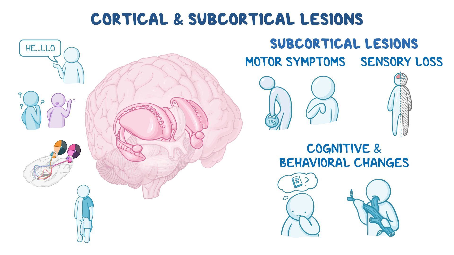 Video Approach To Differentiating Lesions Cerebral Cortical And Subcortical Structures