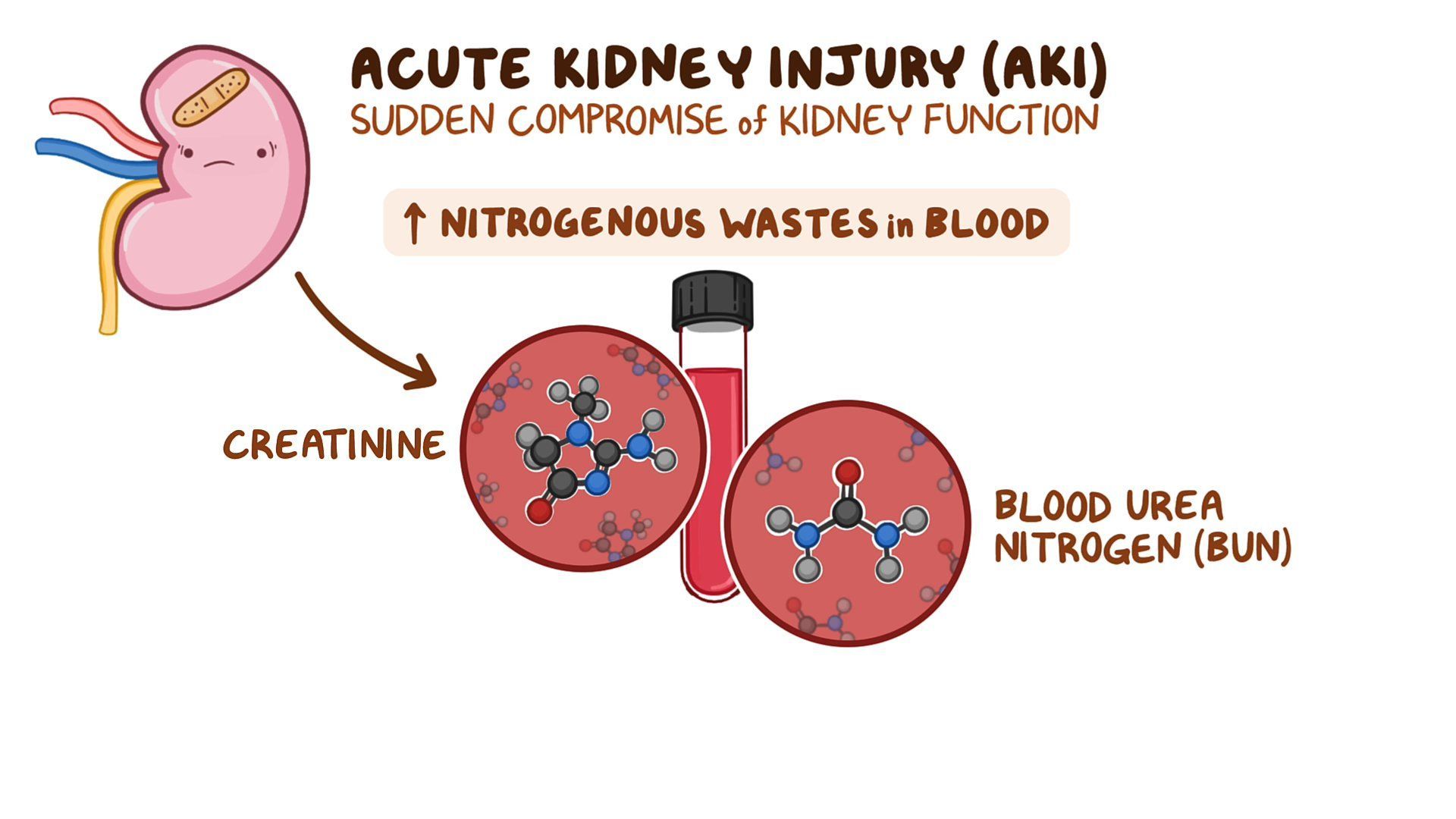 Video: Prerenal acute kidney injury: Clinical sciences