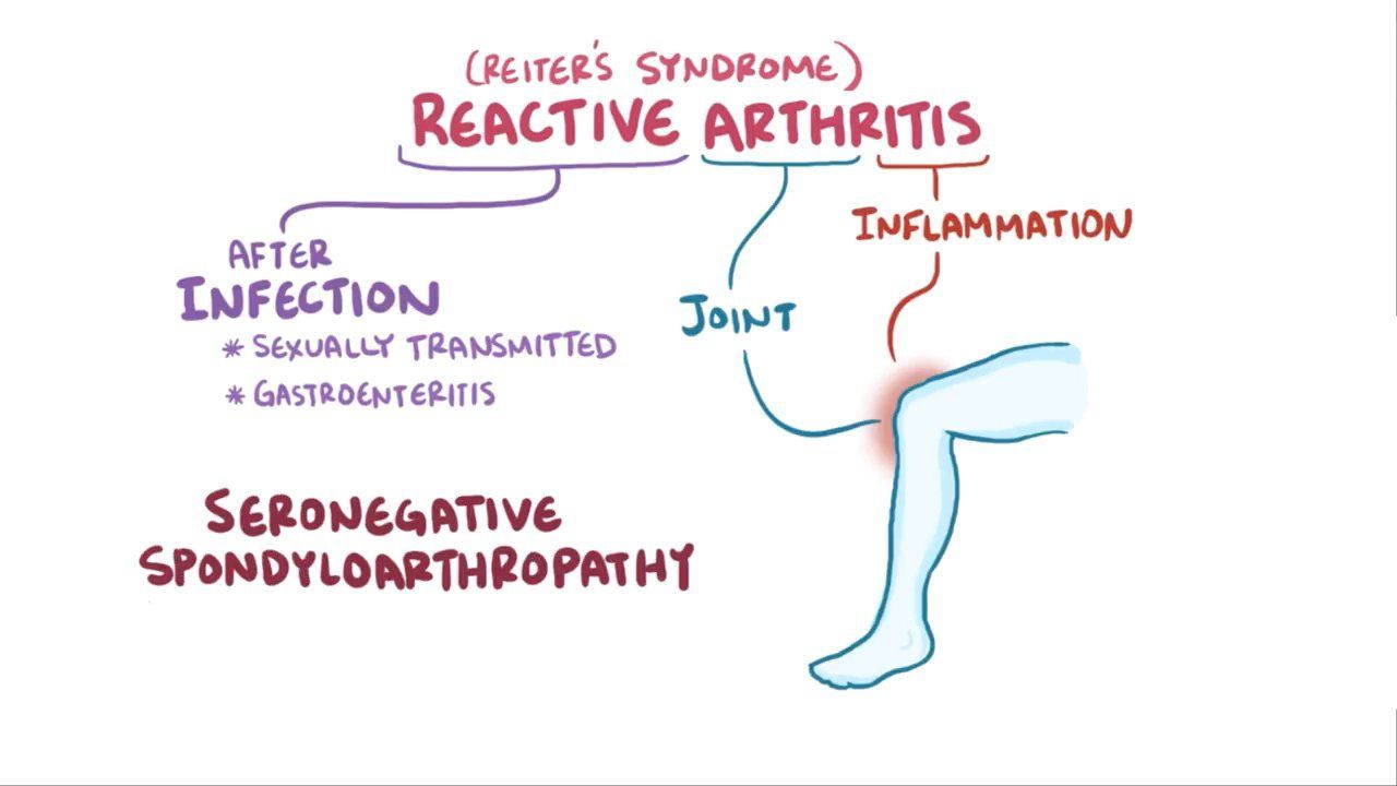 Video Reactive Arthritis Osmosis