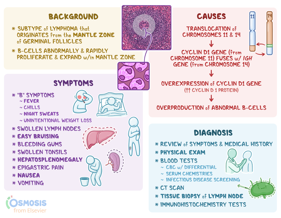 Mantle Cell Lymphoma: What It Is, Causes, Signs and Symptoms, Diagnosi ...