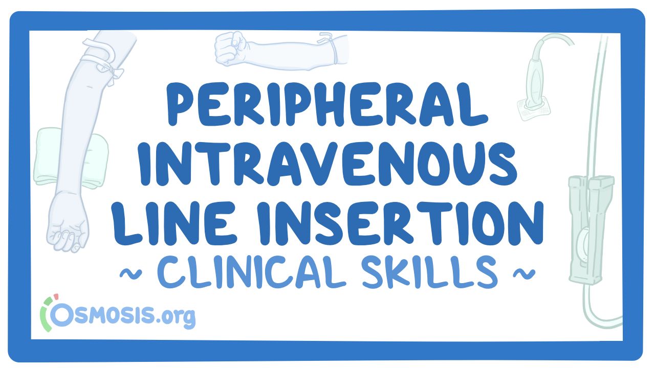 Peripheral intravenous line - Osmosis
