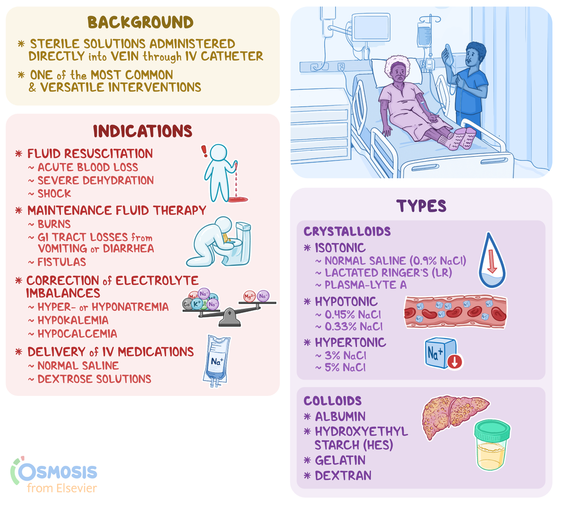 Intravenous (IV) Fluids: What Are They, Types, Indications, and More | Osmosis