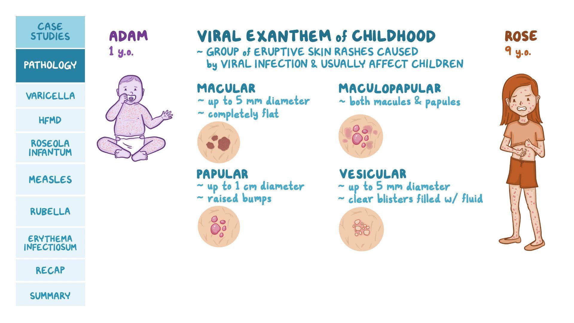 Video: Viral exanthems of childhood: Pathology review | Osmosis