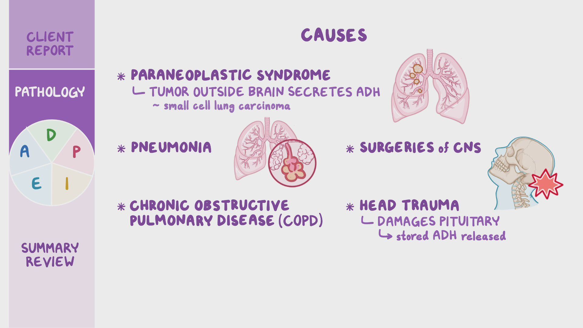 Video: Syndrome of inappropriate antidiuretic hormone (SIADH): Nursing ...