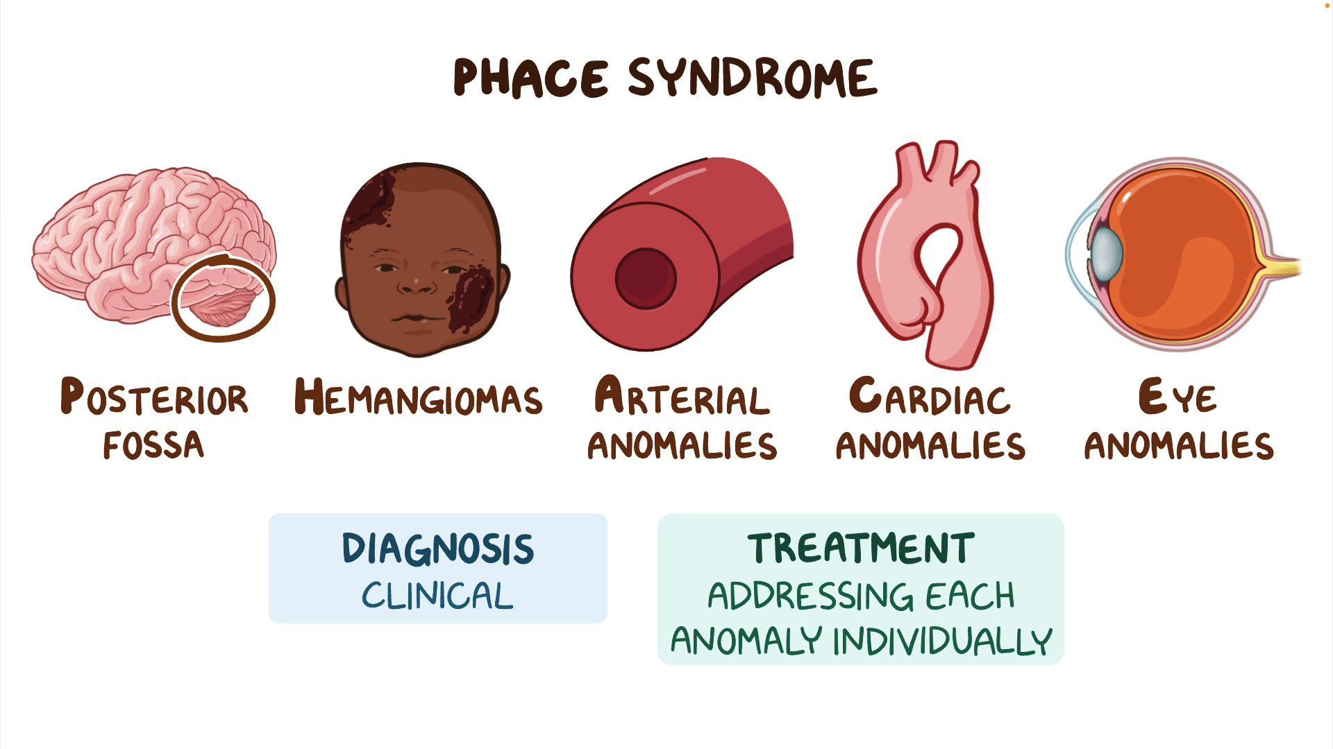 Video: PHACE syndrome: Year of the Zebra