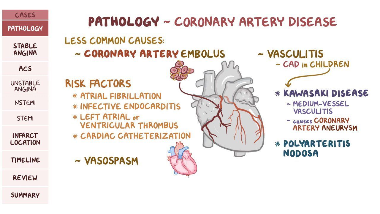 How To Say Coronary Heart Disease Best Design Idea