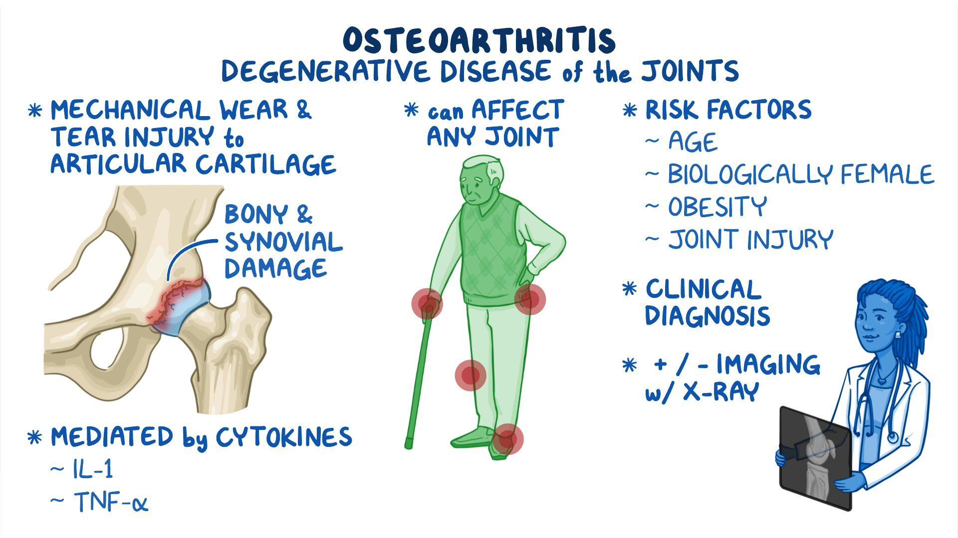 Video Osteoarthritis Clinical Sciences Osmosis Video Osteoarthritis Clinical Sciences Osmosis