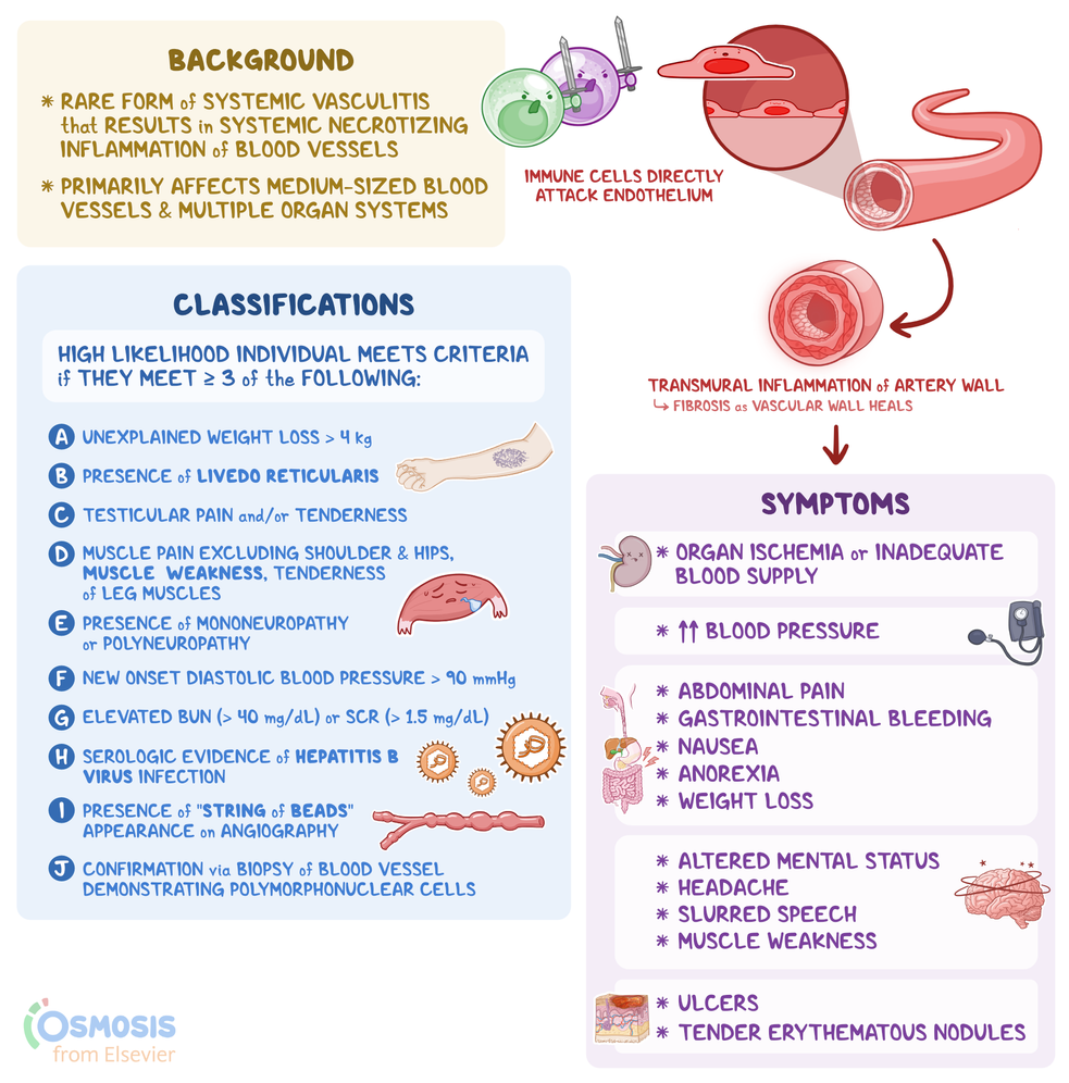 Polyarteritis Nodosa: What It Is, Causes, Signs and Symptoms, Treatmen ...