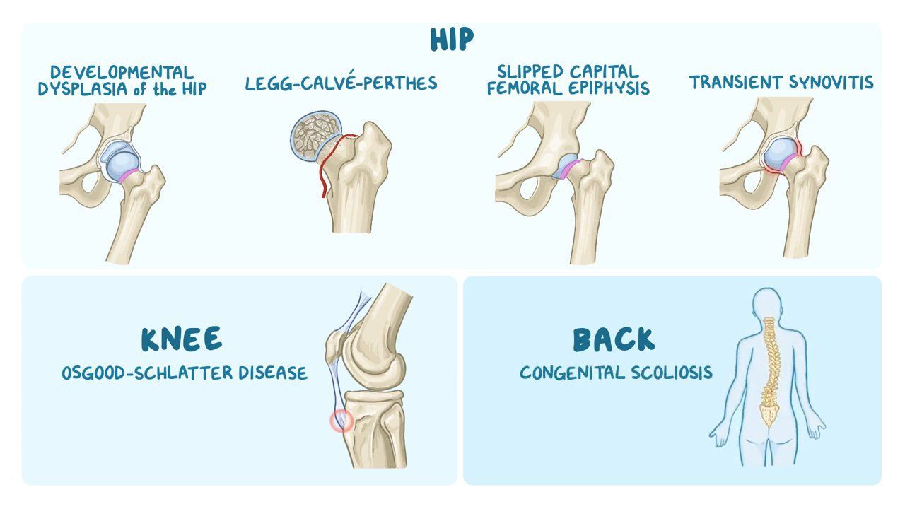 Video Pediatric Orthopedic Conditions Clinical