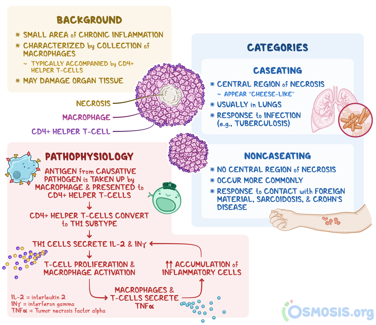 Granulomas What Is It Types Causes And More Osmosis